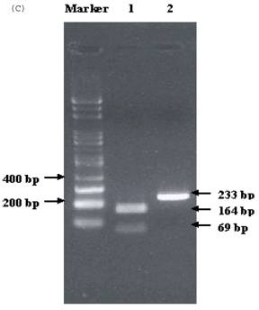 P53 codon 11, 72, and 248 gene polymorphisms in endometriosis