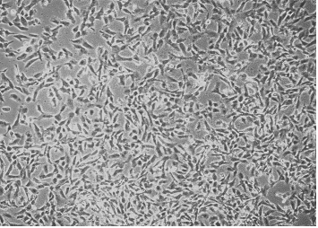 Urokinase Separation from Cell Culture Broth of a Human Kidney Cell Line