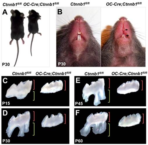 Disruption of Wnt/β-catenin Signaling in Odontoblasts and Cementoblasts Arrests Tooth Root ...