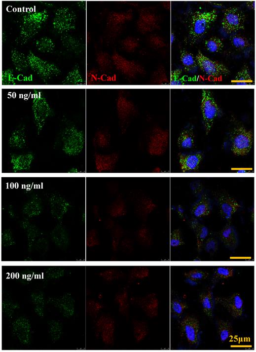 Interleukin-8 Regulates Endothelial Permeability by Down-regulation of ...