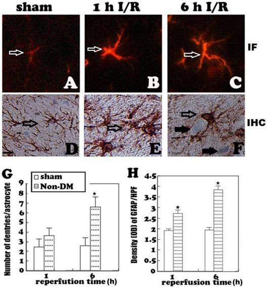 Diabetes Inhibits Cerebral Ischemia-Induced Astrocyte Activation - an ...