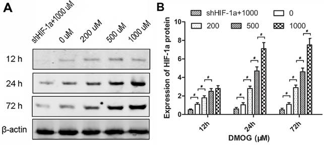 Dimethyloxaloylglycine Improves Angiogenic Activity of Bone Marrow ...