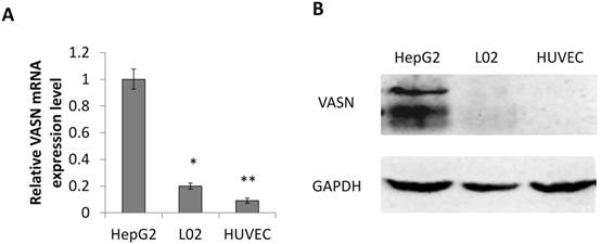 Exosomal Transfer of Vasorin Expressed in Hepatocellular Carcinoma ...