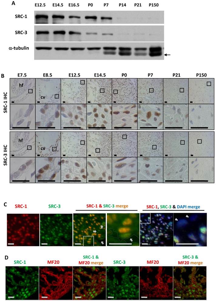 Knockout of SRC-1 and SRC-3 in Mice Decreases Cardiomyocyte ...