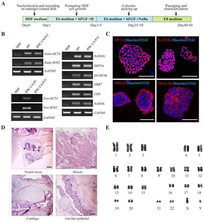Transcriptional Reactivation of OTX2, RX1 and SIX3 during Reprogramming ...