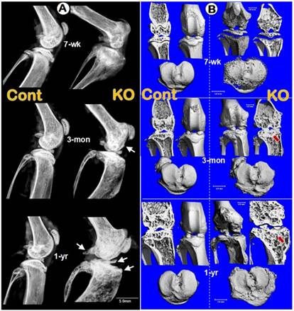 Dmp1 Null Mice Develop a Unique Osteoarthritis-like Phenotype