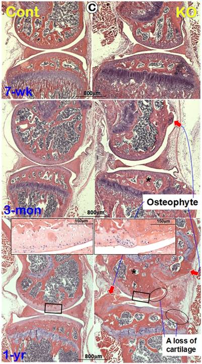 Dmp1 Null Mice Develop a Unique Osteoarthritis-like Phenotype