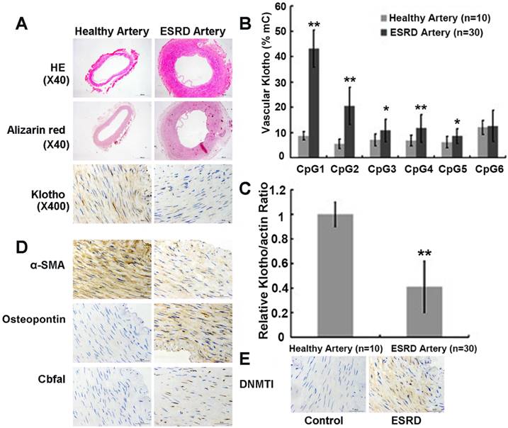 Indoxyl Sulfate Enhance the Hypermethylation of Klotho and Promote the ...