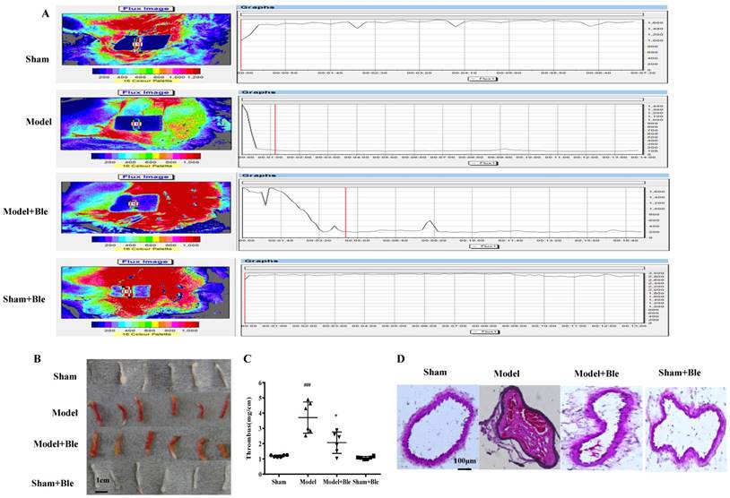 The Myosin II Inhibitor, Blebbistatin, Ameliorates FeCl3-induced ...