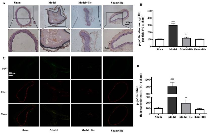 The Myosin II Inhibitor, Blebbistatin, Ameliorates FeCl3-induced ...