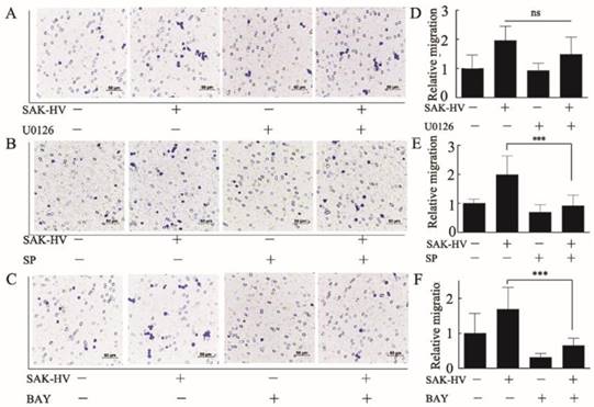 SAK-HV Promotes RAW264.7 cells Migration Mediated by MCP-1 via JNK and ...