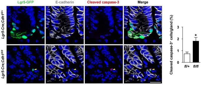 E-cadherin is Required for the Homeostasis of Lgr5+ Gastric Antral Stem ...