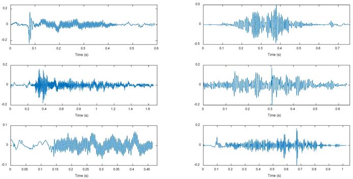 A Lung Sound Category Recognition Method Based on Wavelet Decomposition ...