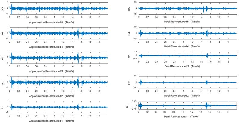 A Lung Sound Category Recognition Method Based on Wavelet Decomposition ...