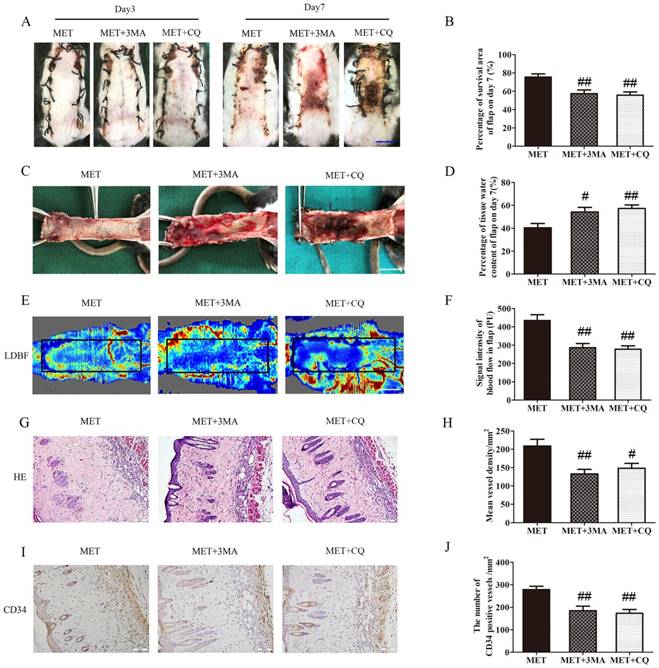 Metformin Promotes the Survival of Random-Pattern Skin Flaps by ...