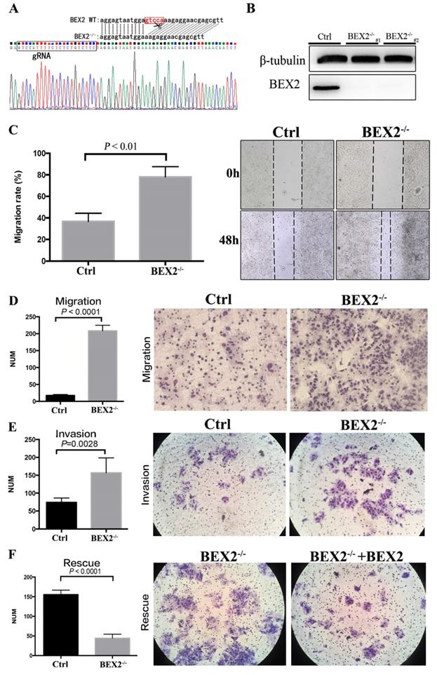 Silencing of brain-expressed X-linked 2 (BEX2) promotes colorectal ...
