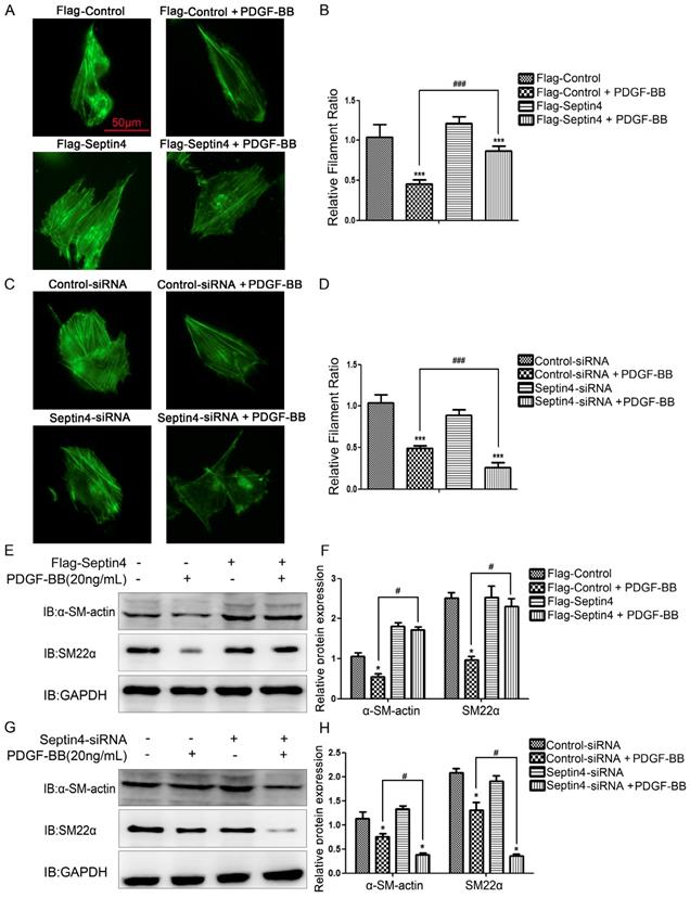 Septin4 Prevents PDGF-BB-induced HAVSMC Phenotypic Transformation ...