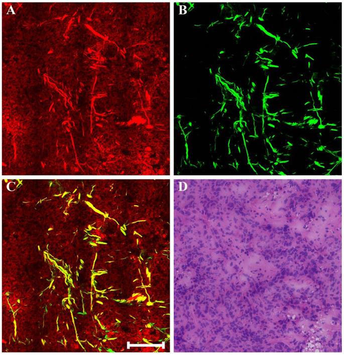 Label-free multiphoton imaging to assess neoadjuvant therapy responses ...