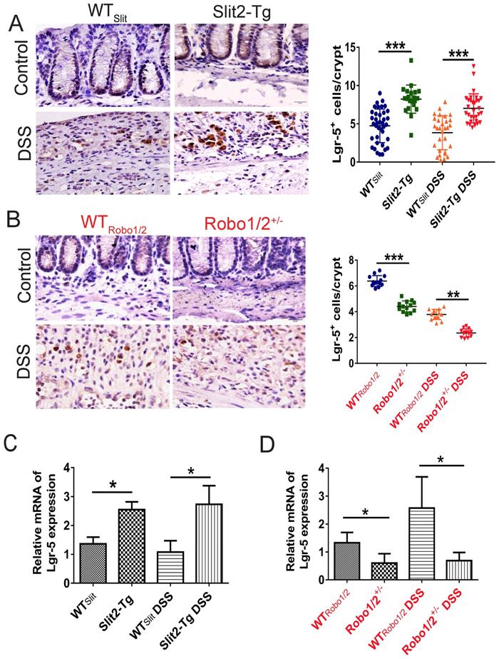 Slit2/Robo1 Mitigates DSS-induced Ulcerative Colitis by Activating ...