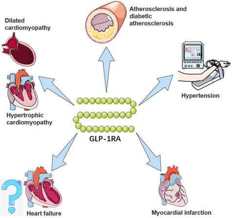 GLP-1 receptor agonists (GLP-1RAs): cardiovascular actions and ...