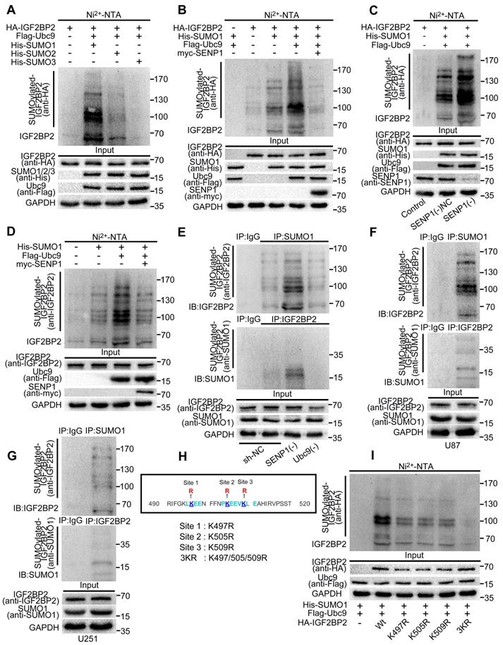 SUMOylation of IGF2BP2 promotes vasculogenic mimicry of glioma via ...