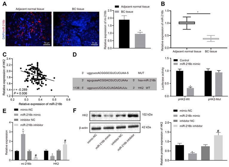 MicroRNA-216b targets HK2 to potentiate autophagy and apoptosis of ...