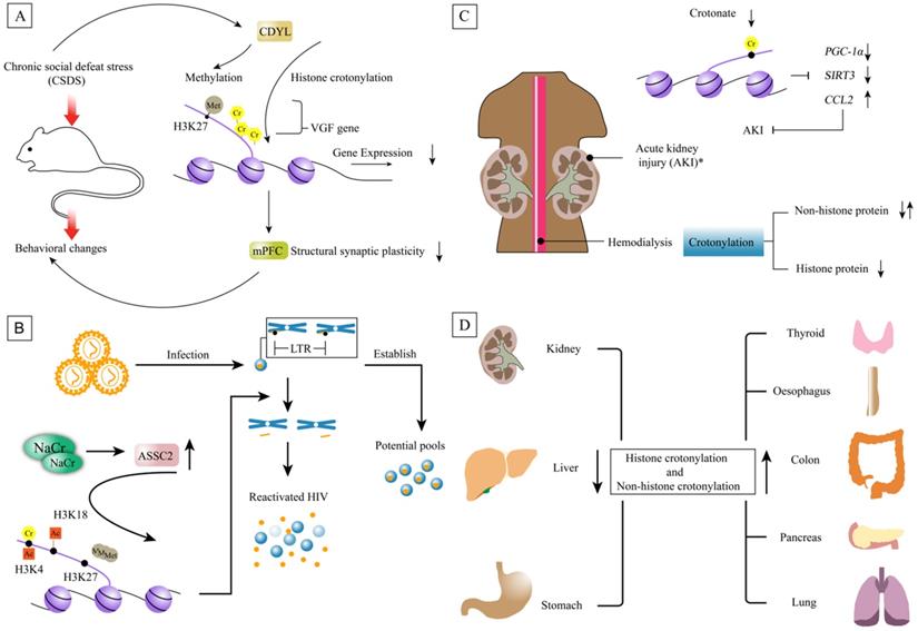 The Function and related Diseases of Protein Crotonylation