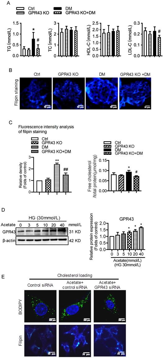 GPR43 activation-mediated lipotoxicity contributes to podocyte injury ...