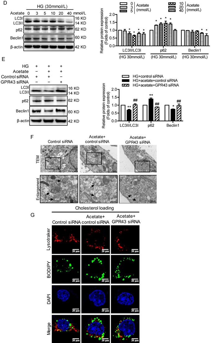 GPR43 activation-mediated lipotoxicity contributes to podocyte injury ...