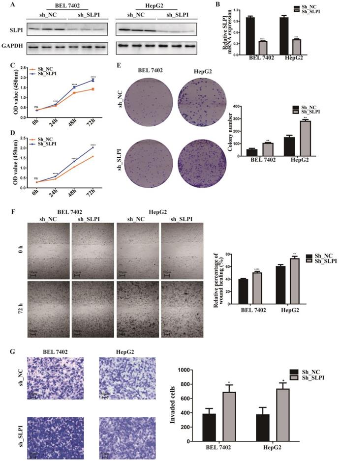SLPI suppresses hepatocellular carcinoma progression via endoplasmic ...