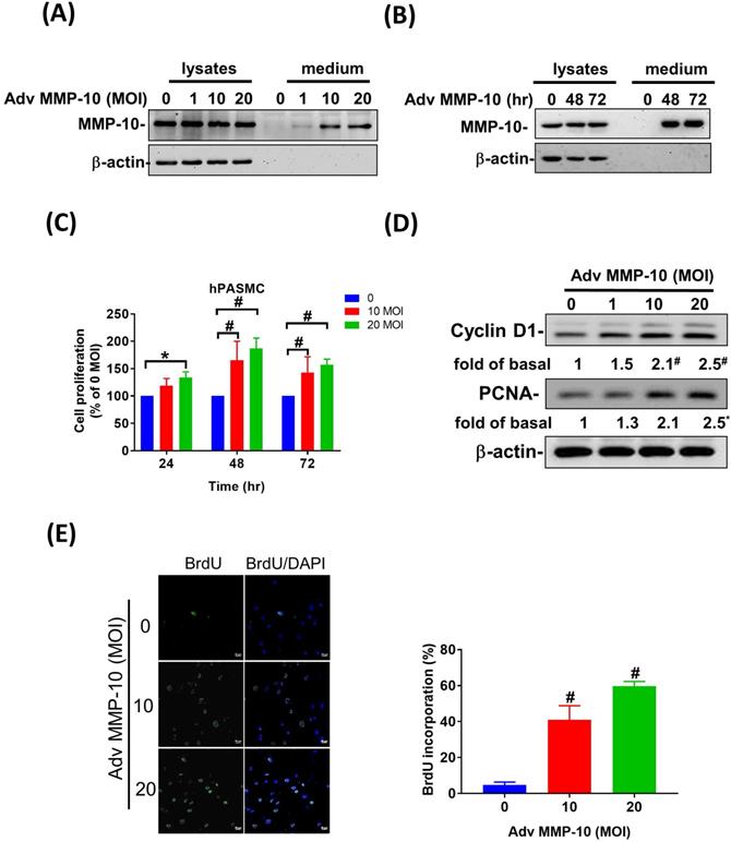 MMP-10 from M1 macrophages promotes pulmonary vascular remodeling and ...