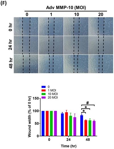 MMP-10 from M1 macrophages promotes pulmonary vascular remodeling and ...