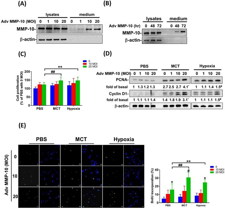 MMP-10 from M1 macrophages promotes pulmonary vascular remodeling and ...