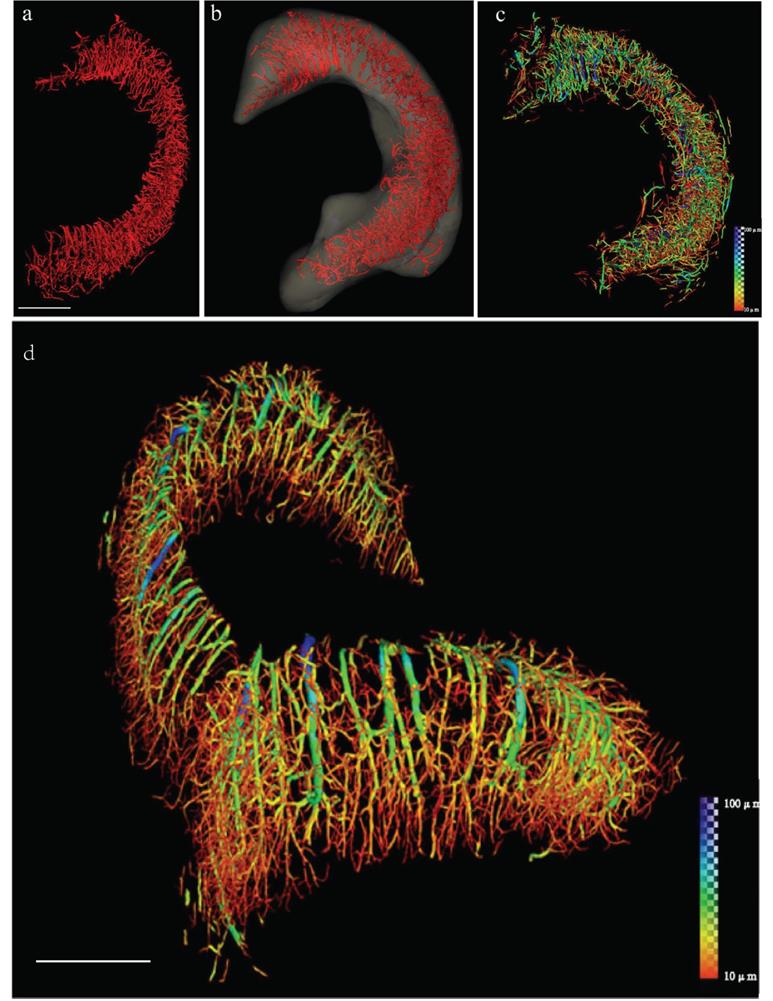 Advanced high resolution three-dimensional imaging to visualize the ...