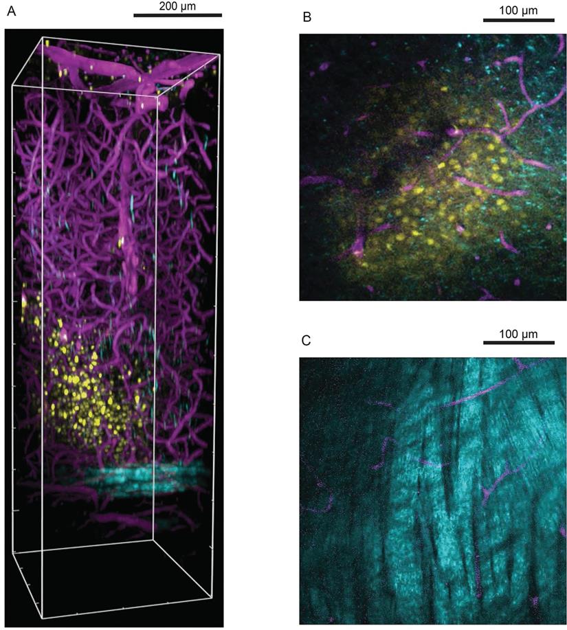 Advanced high resolution three-dimensional imaging to visualize the ...