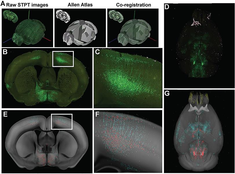 Advanced high resolution three-dimensional imaging to visualize the ...