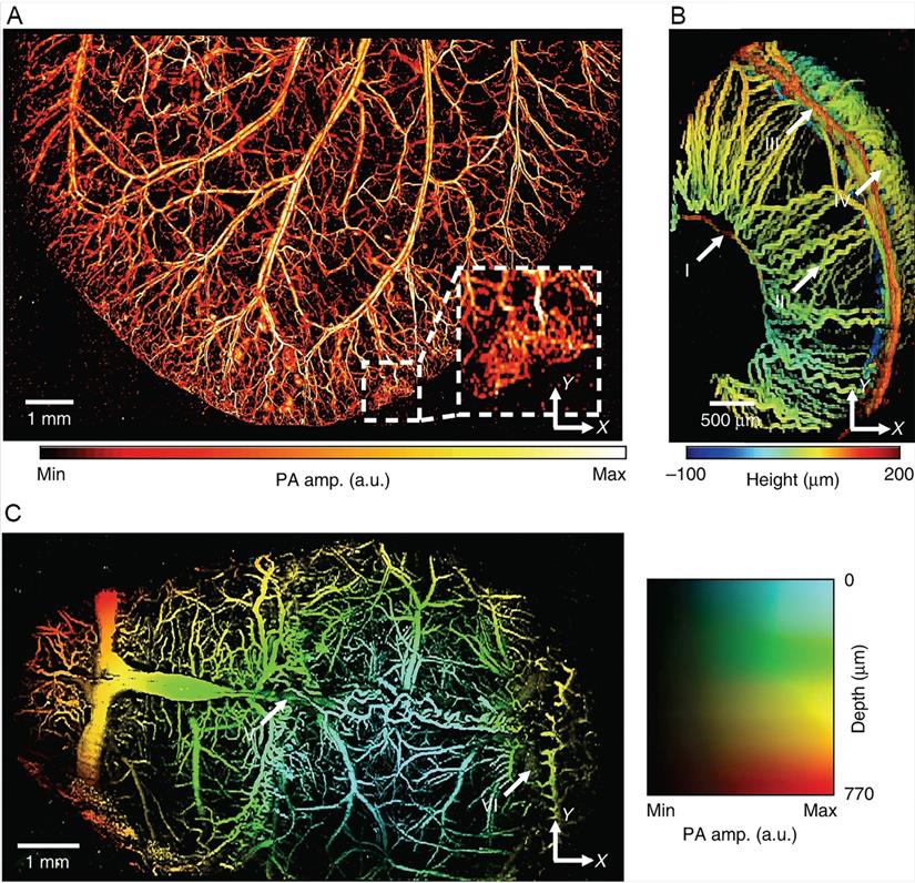 Advanced high resolution three-dimensional imaging to visualize the ...