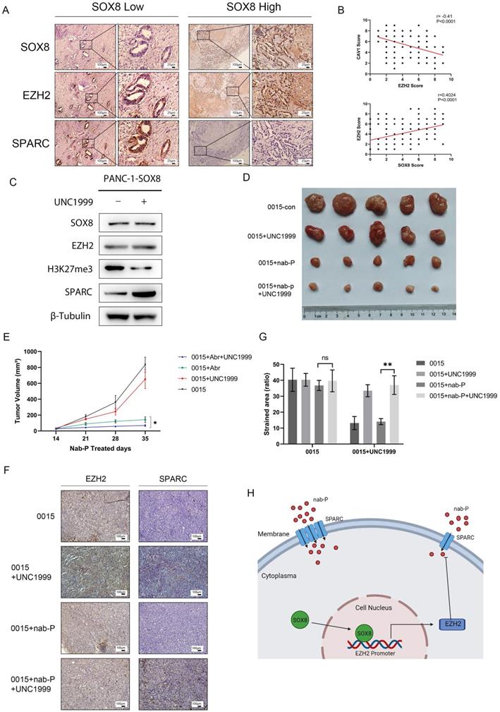 SOX8 Affects Tumoral SPARC Expression by Regulating EZH2 to Attenuate ...