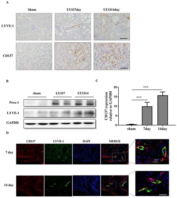 CD137L-macrophage induce lymphatic endothelial cells autophagy to ...