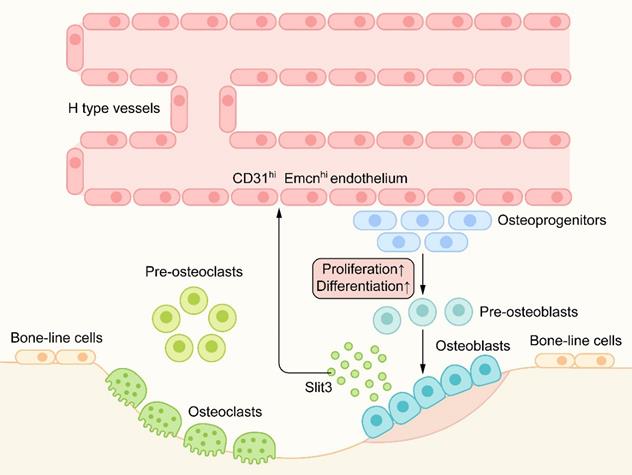 Role of Slit/Robo Signaling pathway in Bone Metabolism