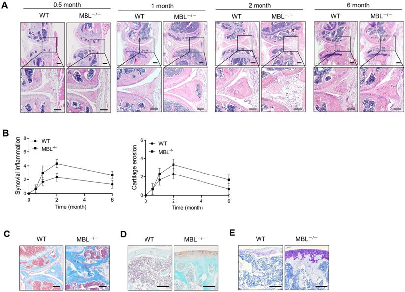 Mannan-Binding Lectin Deficiency Limits Inflammation-induced Myeloid ...