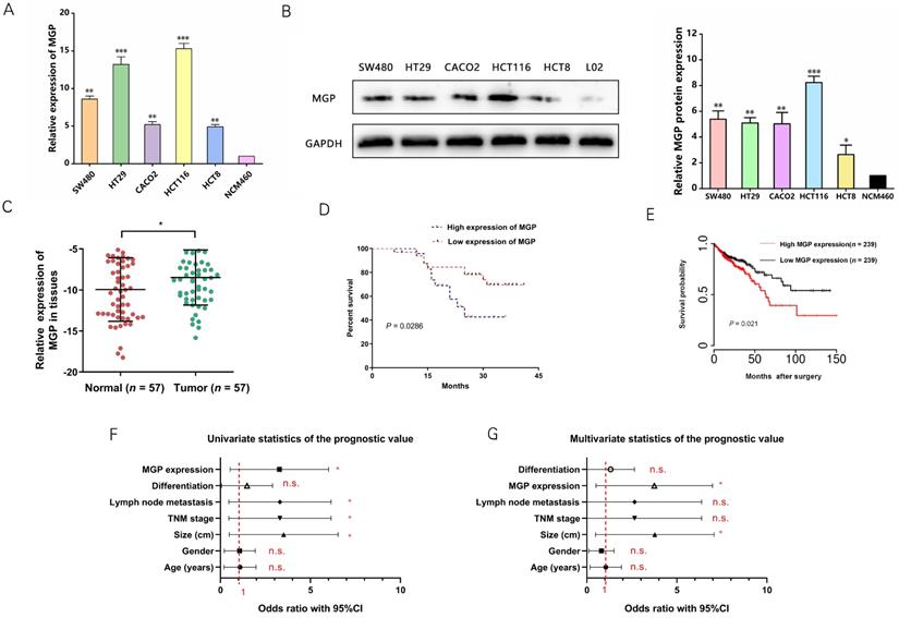 MGP promotes CD8+ T cell exhaustion by activating the NF-κB pathway ...