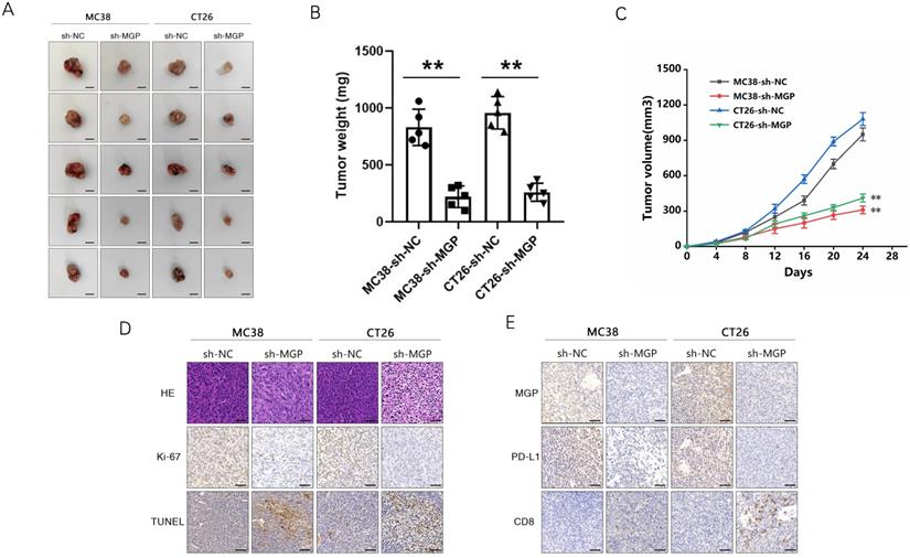 MGP promotes CD8+ T cell exhaustion by activating the NF-κB pathway ...