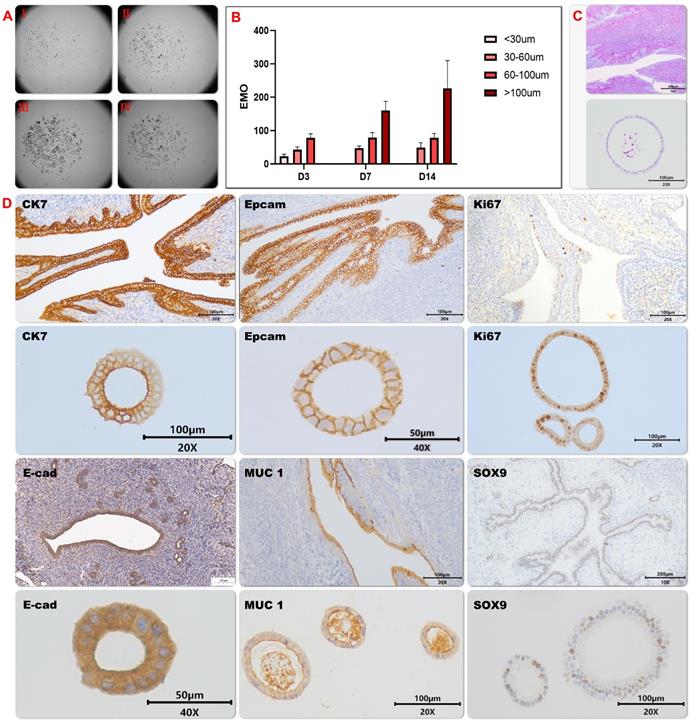 Organoid Transplantation Can Improve Reproductive Prognosis by ...