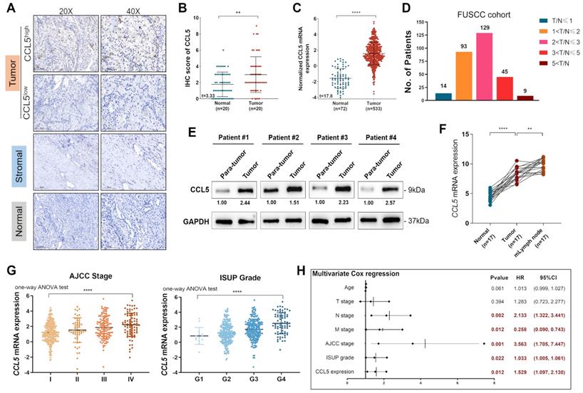 Tumor-associated macrophage-derived chemokine CCL5 facilitates the ...