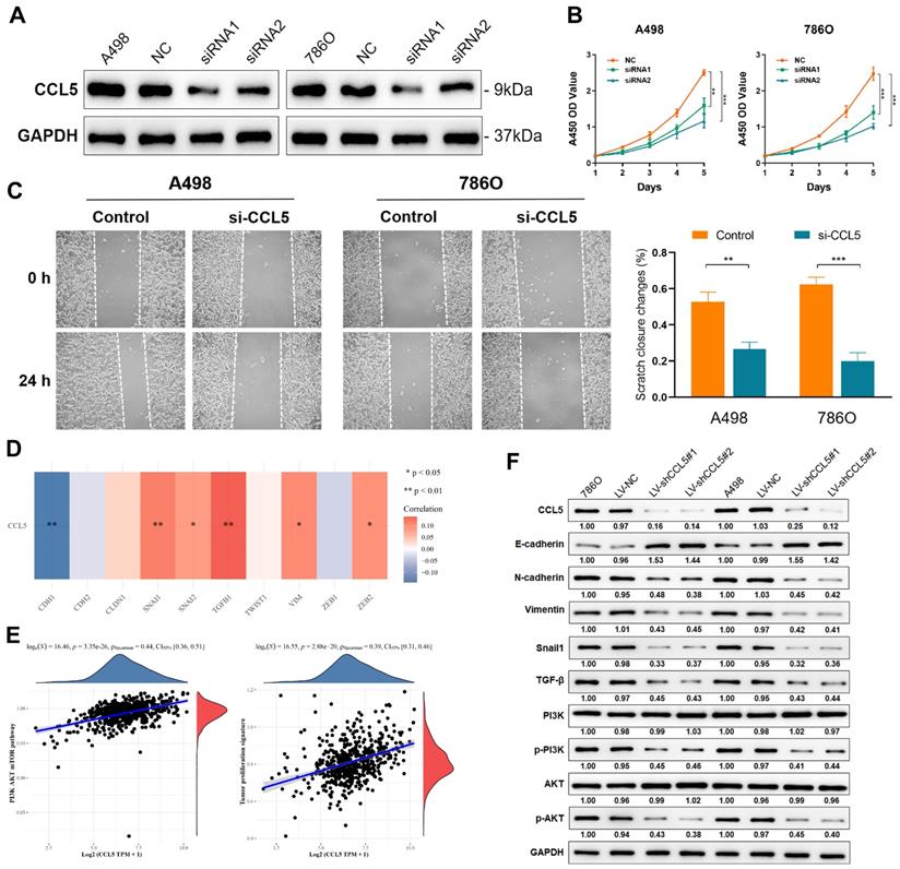Tumor-associated macrophage-derived chemokine CCL5 facilitates the ...