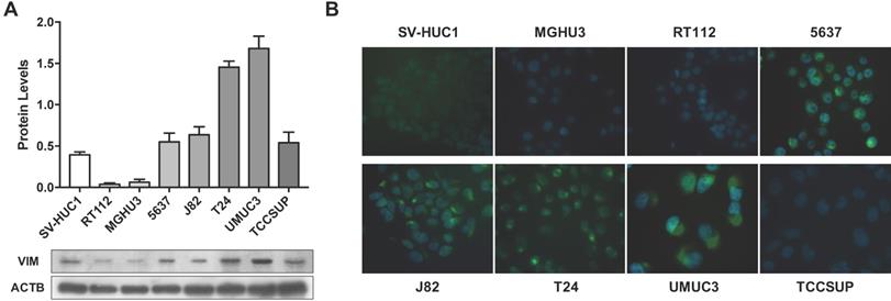 Vimentin epigenetic deregulation in Bladder Cancer associates with ...