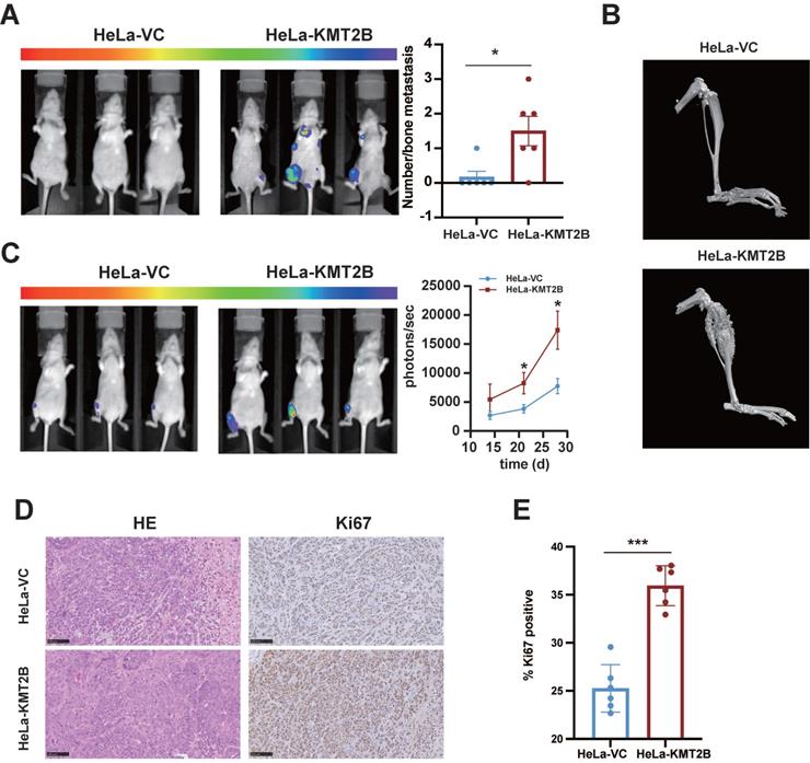 Histone Methyltransferase KMT2B Promotes Metastasis and Angiogenesis of ...