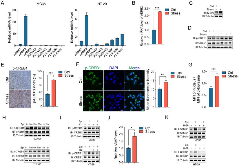 Chronic stress promotes colorectal cancer progression by enhancing ...