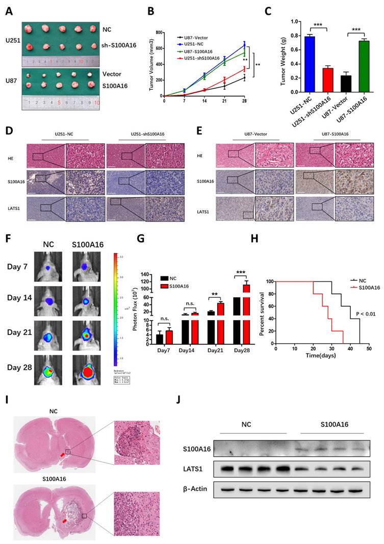 S100 Calcium Binding Protein A16 Promotes Cell Proliferation by ...